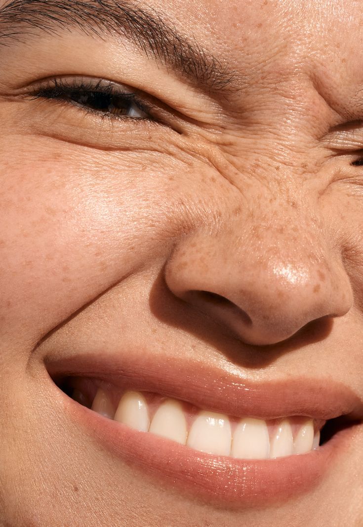Dehydrated Skin vs. Dry Skin: Here’s How to Spot the Difference – BLOS
